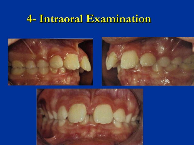 Growth modification of different types of malocclusion | PPTX