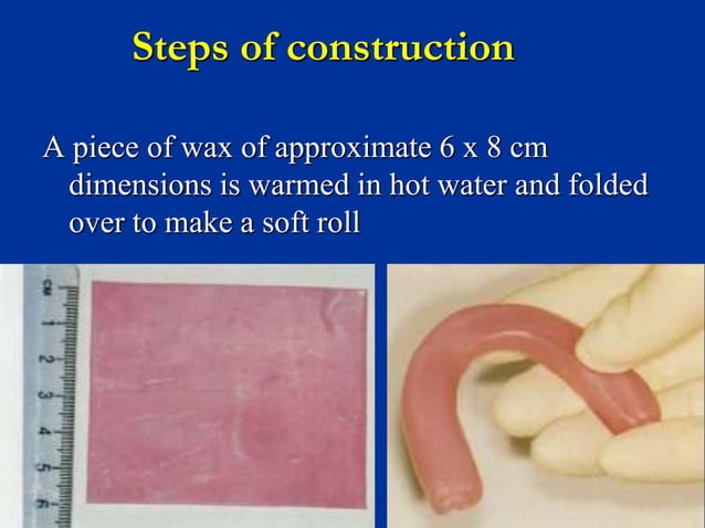 Growth modification of different types of malocclusion | PPTX