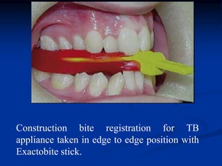 Growth modification of different types of malocclusion | PPTX