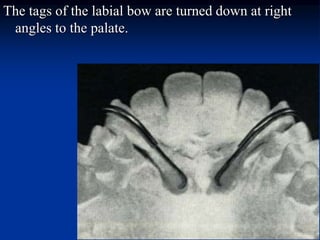 Growth modification of different types of malocclusion | PPTX
