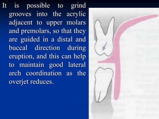 Growth modification of different types of malocclusion | PPTX