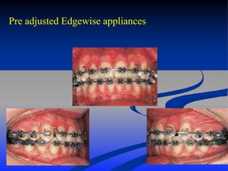 Growth modification of different types of malocclusion | PPTX