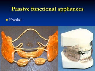 Growth modification of different types of malocclusion | PPTX