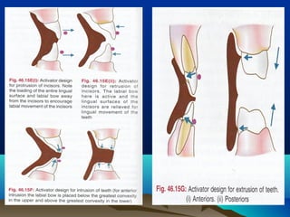 Growth Modification Treatment | PPT