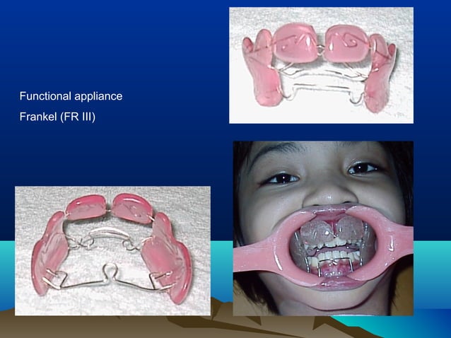 Growth Modification Treatment | PPT