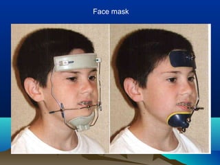 Growth Modification Treatment | PPT