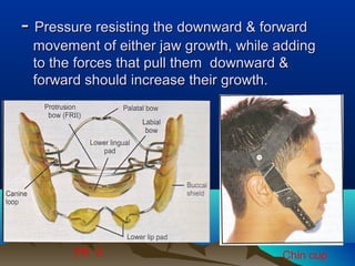 Growth Modification Treatment | PPT
