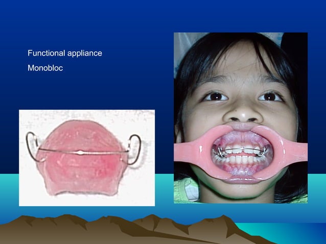 Growth Modification Treatment | PPT