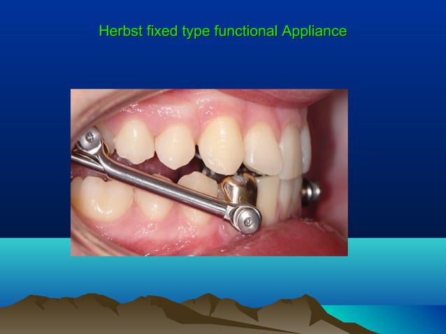 Growth Modification Treatment | PPT
