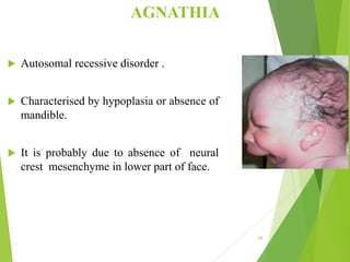 Growth and development of mandible | PPT