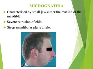 Growth and development of mandible | PPT