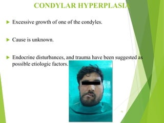Growth and development of mandible | PPT