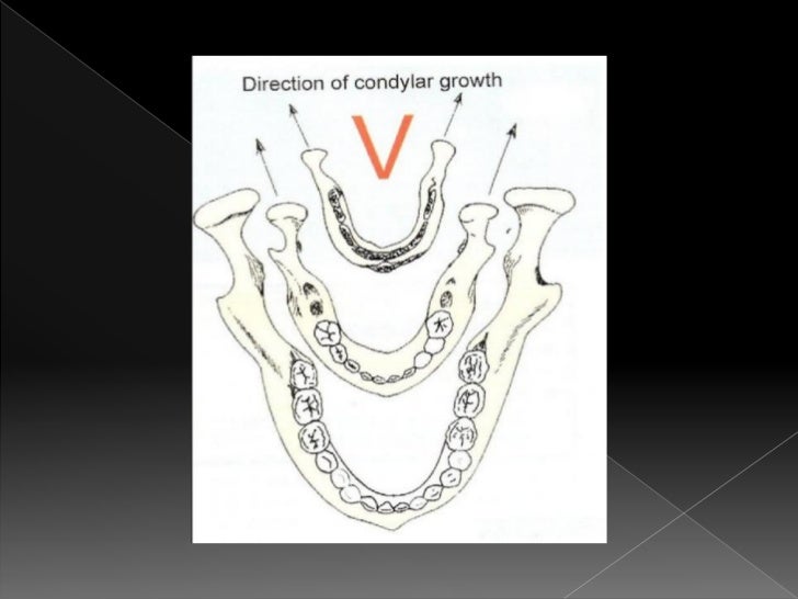 Growth of mandible