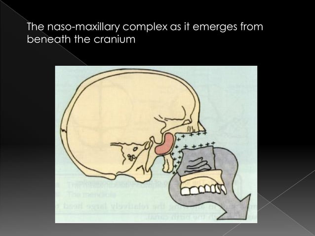 Growth of maxilla | PDF | Bone and Joint Conditions | Diseases and ...