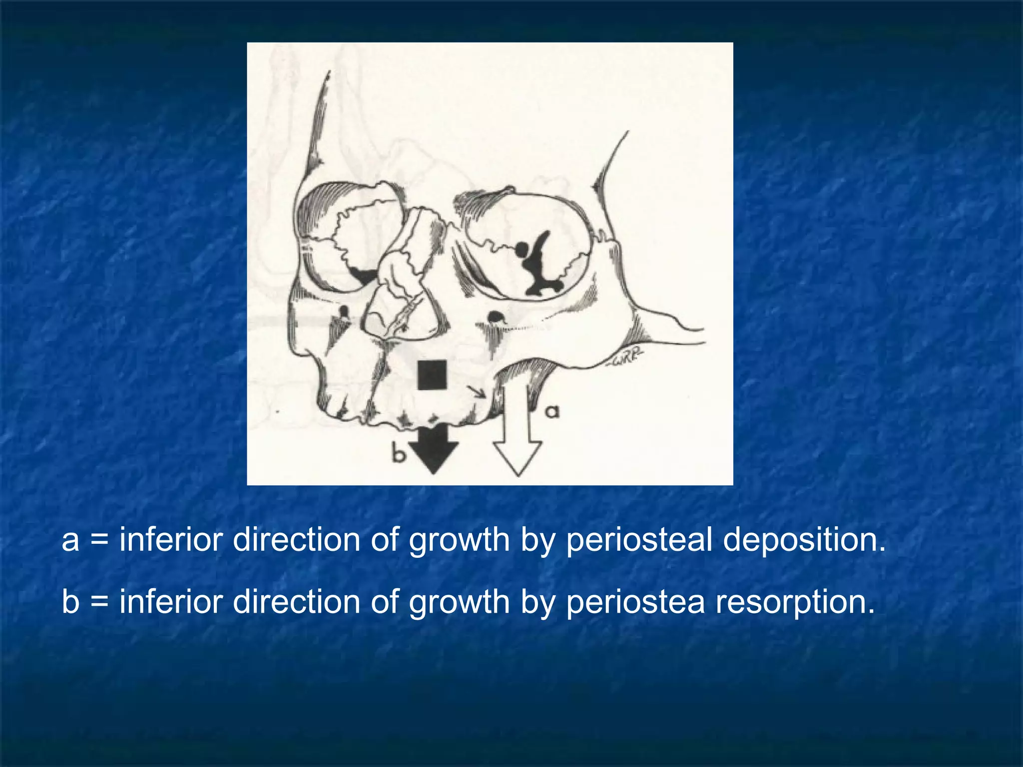 Growth of Nasomaxillary Complex and Mandible | PPT