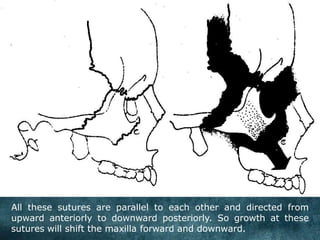 Growth of the maxilla | PPTX