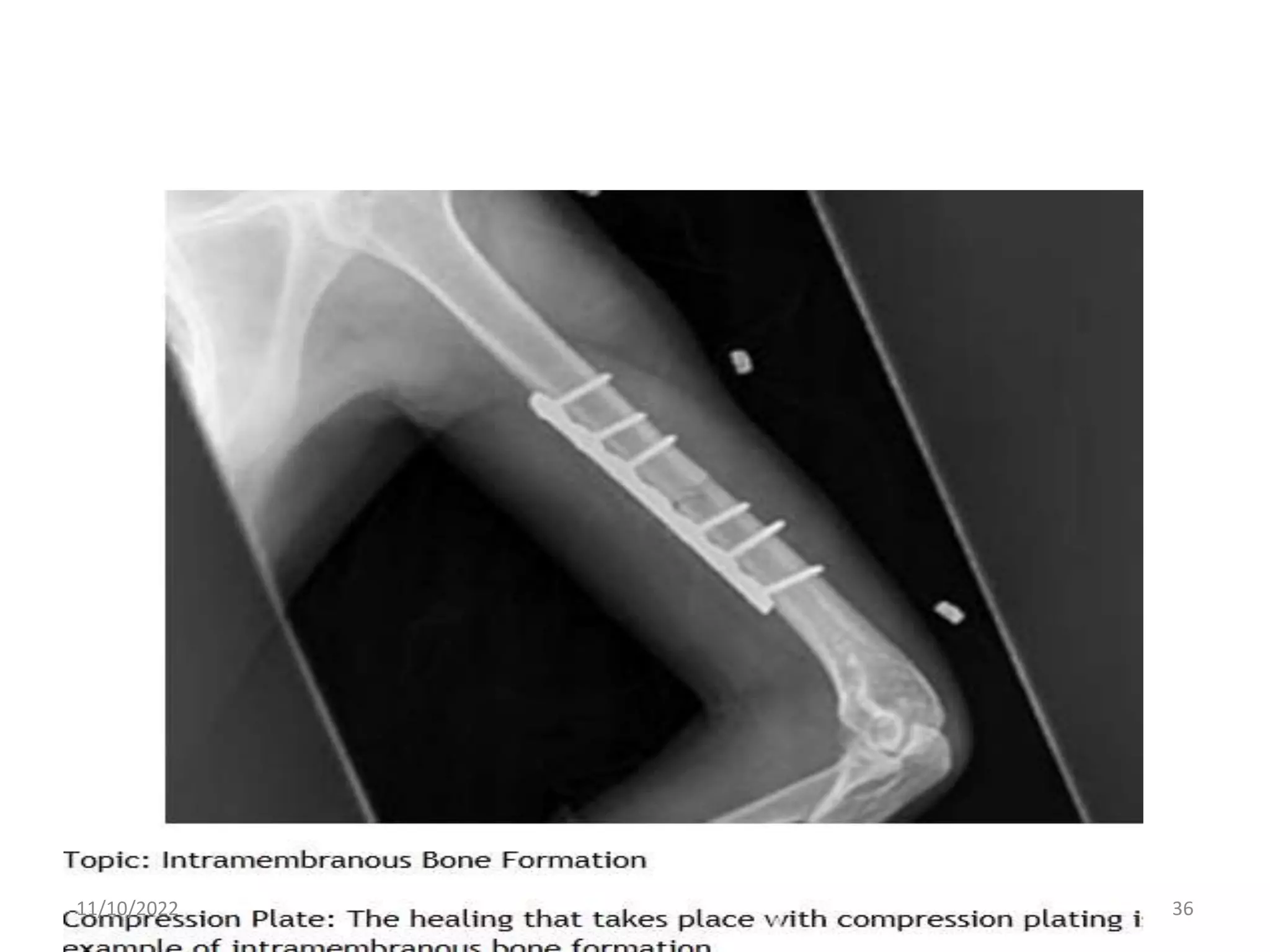 Growth plate and Bone development.pptx | Bone and Joint Conditions ...