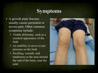 Growth plate (physeal) fracture | PDF