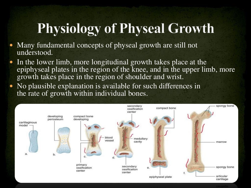 Growth plate (physeal) fracture