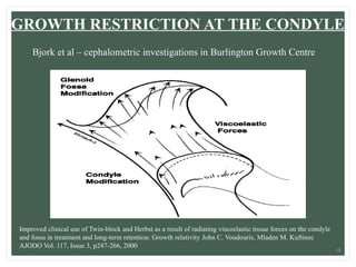 GROWTH RELATIVITY HYPOTHESIS ORTHODONTICS.pptx