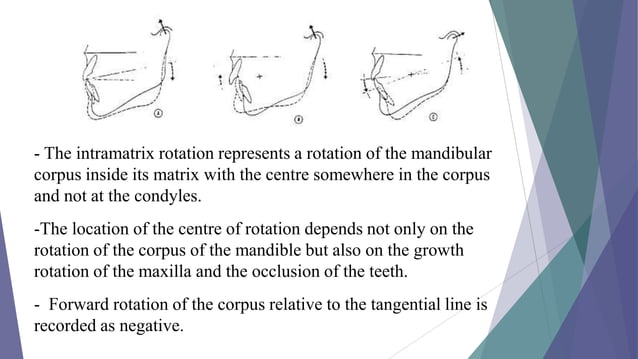 Growth rotations | PPTX | Bone and Joint Conditions | Diseases and ...