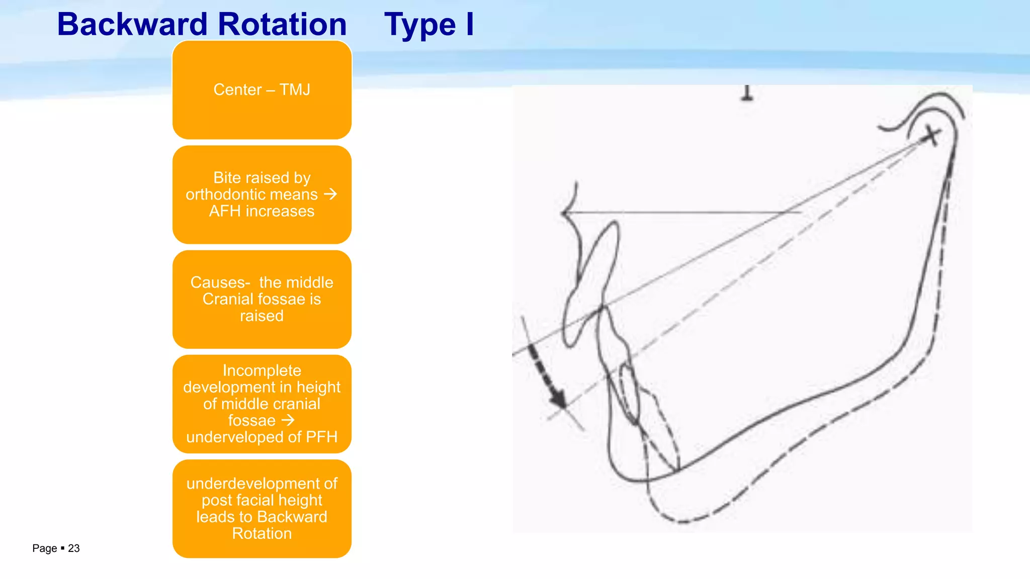 Growth rotations in orthodontics | PPTX
