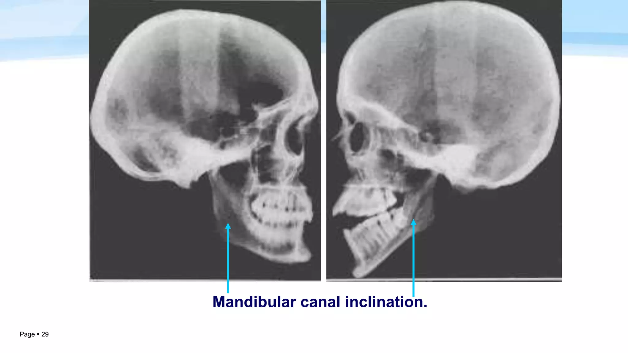 Growth rotations in orthodontics | PPTX