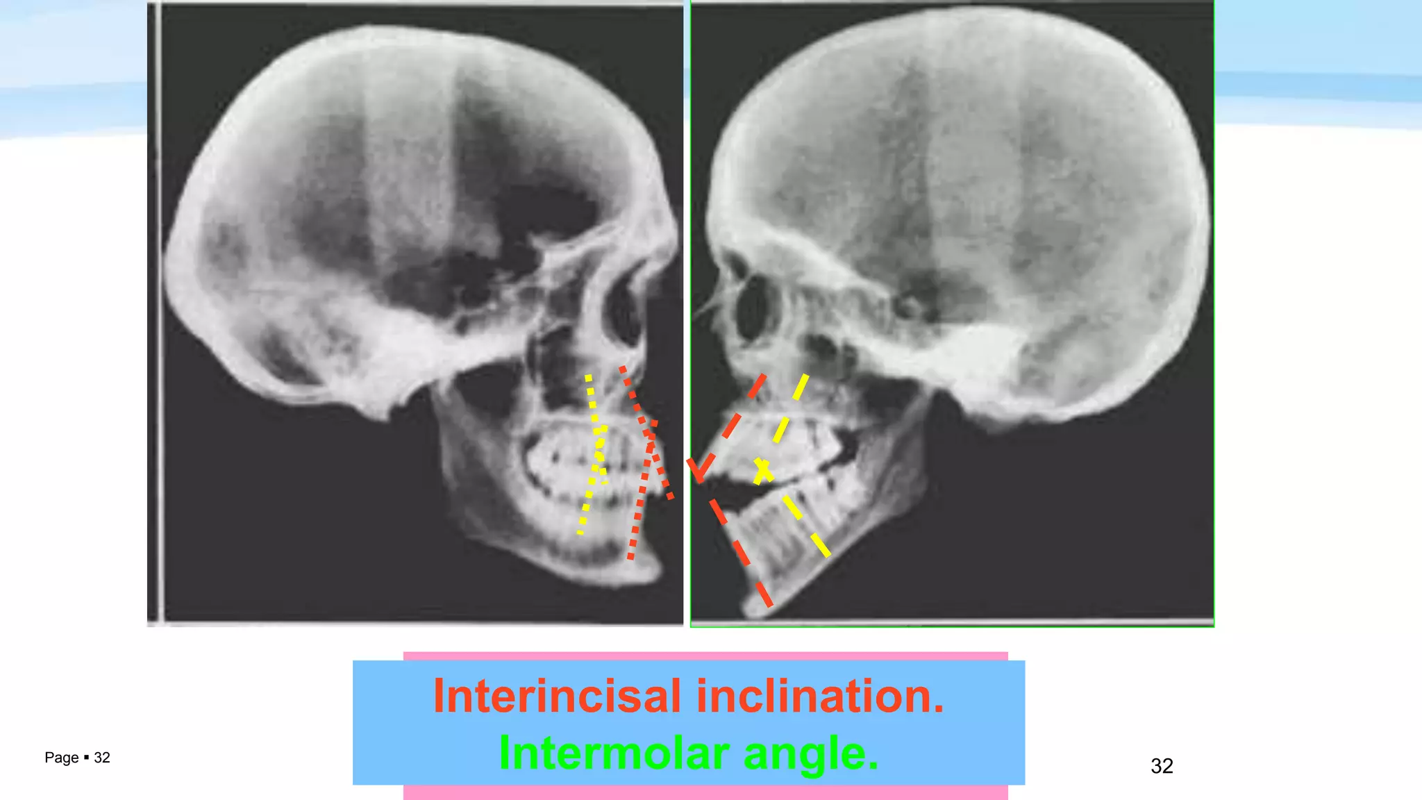 Growth rotations in orthodontics | PPTX