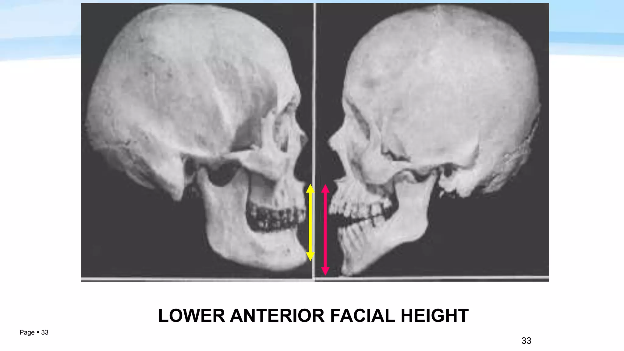 Growth rotations in orthodontics | PPTX