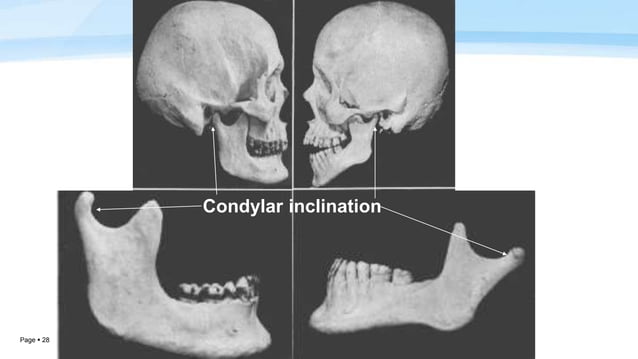 Growth rotations in orthodontics | PPTX