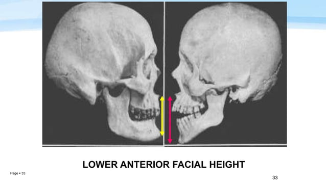 Growth rotations in orthodontics | PPTX