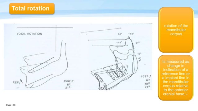 Growth rotations in orthodontics | PPTX