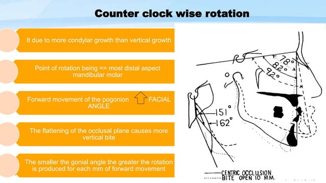 Growth rotations in orthodontics | PPTX