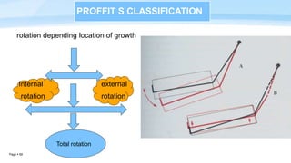 Growth rotations in orthodontics | PPTX