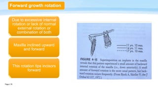 Growth rotations in orthodontics | PPTX
