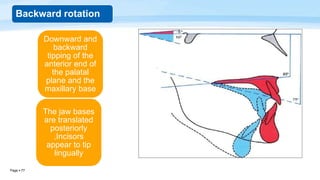 Growth rotations in orthodontics | PPTX
