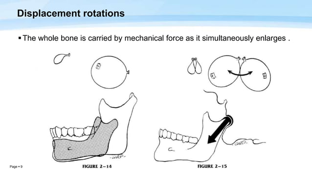 Growth rotations in orthodontics | PPTX