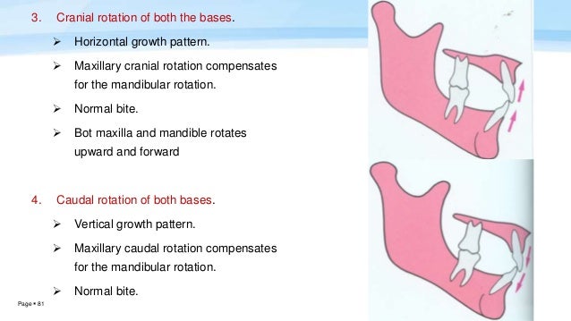 Growth rotations in orthodontics