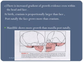 Growth spurts - orthodontics | PDF