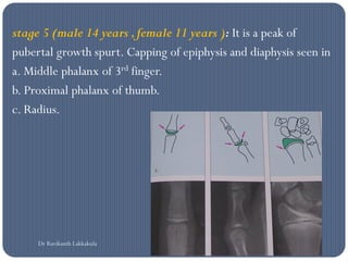 Growth spurts - orthodontics | PDF