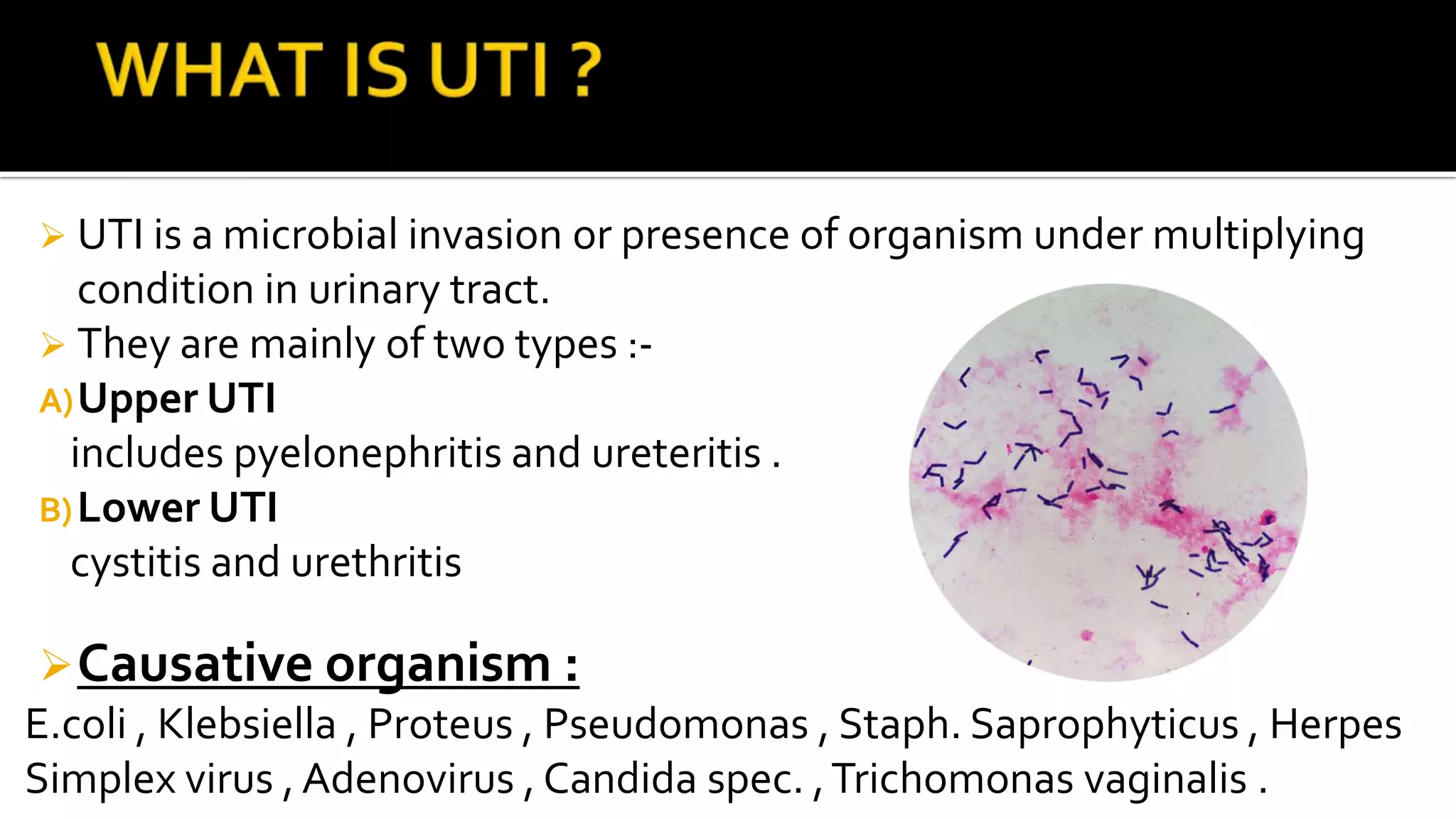DRUGS OF UTI | PPTX