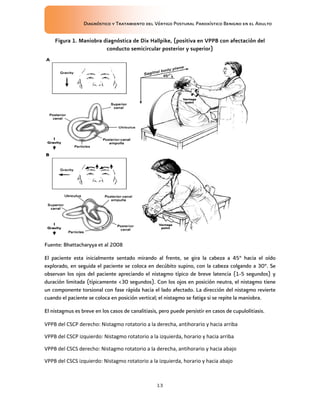 Guía de Referencia Vértigo Postural | PDF