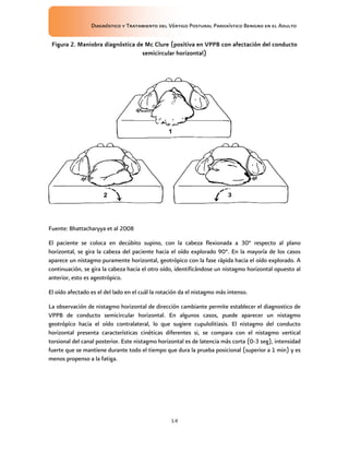 Guía de Referencia Vértigo Postural | PDF