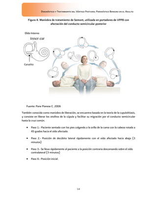 Guía de Referencia Vértigo Postural | PDF