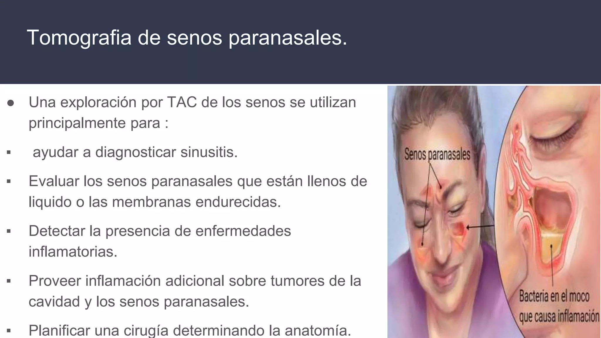 Anatomia analitica de cabeza,cuello y senos paranasales.pptx