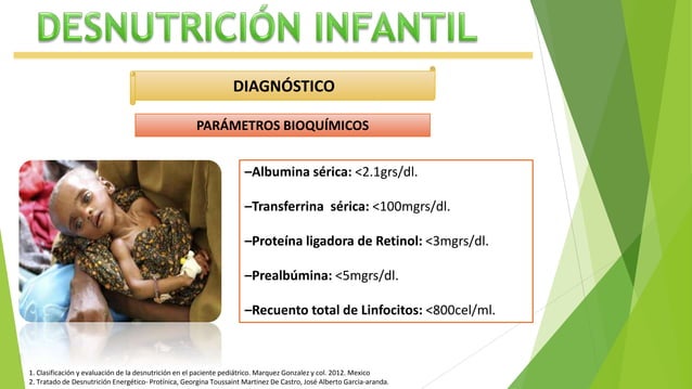 Desnutricion Pediatria Ppt