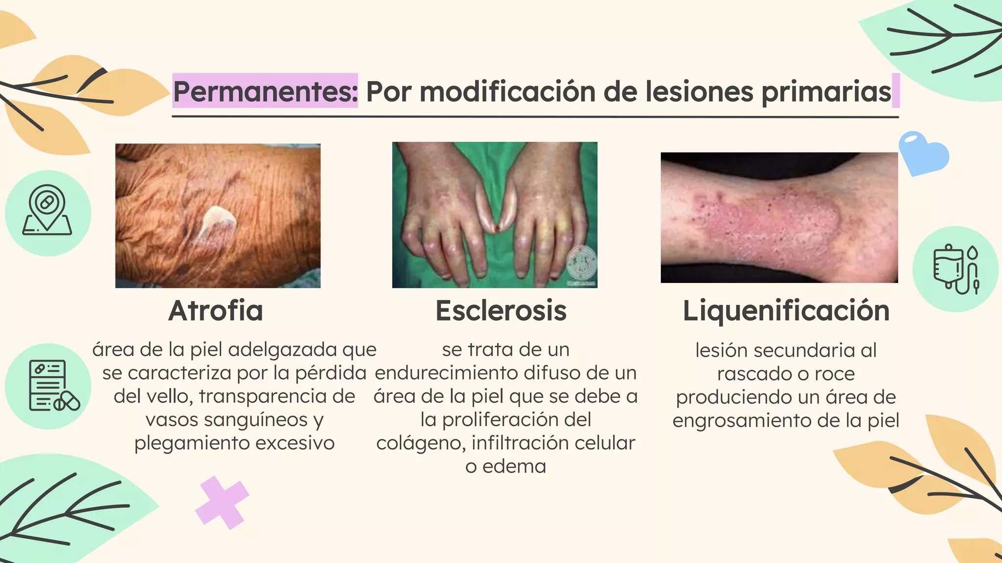 Grupo 2 Lesiones elementales de la piel.pptx