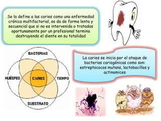 caries dental | PPTX