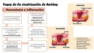 CICATRIZACION DE HERIDAS | PPTX
