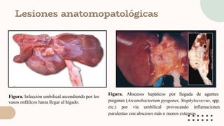 Onfalitis (Onfaloflebitis, Onfaloarteritis) | PDF
